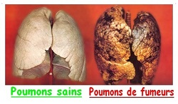 poumon-sain-et-poumon-fumeur | Holistic Attitude